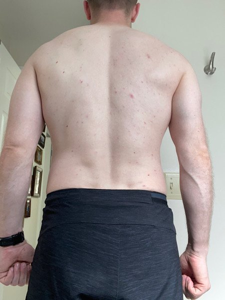 Research Participant 574 - Body Type One (BT1) Male (Man), Millennial ...